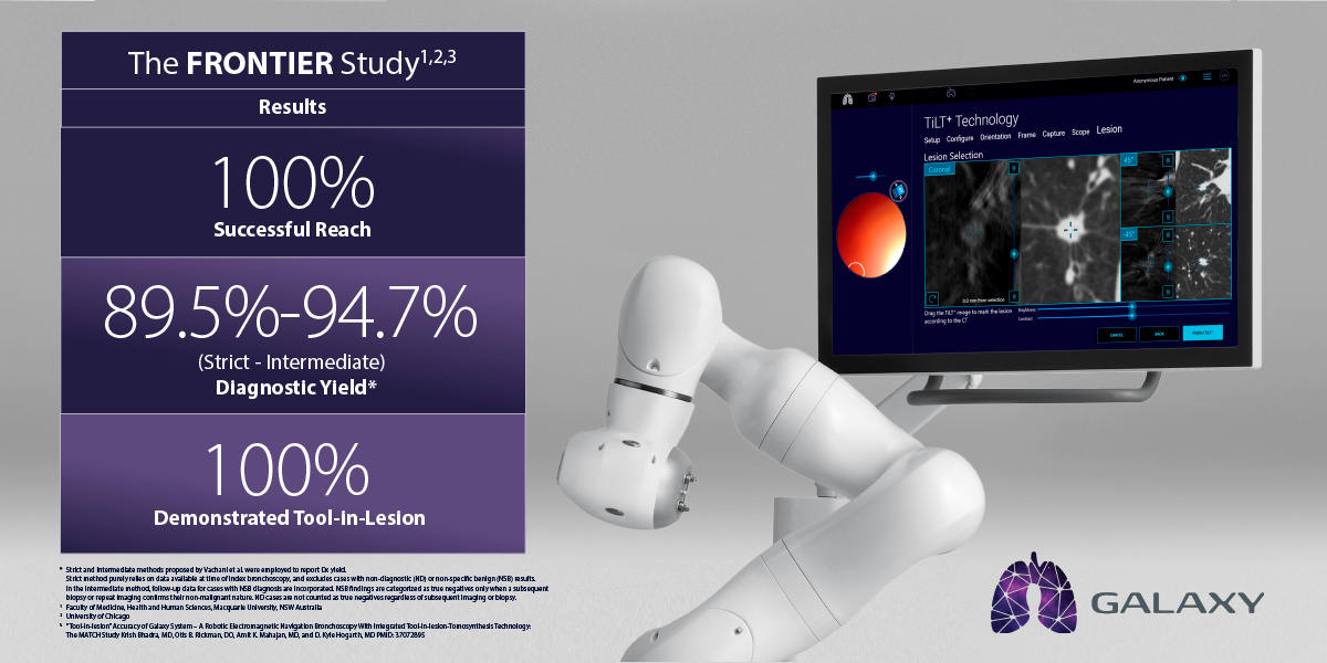First-in-Human Clinical Trial of the Galaxy System - FRONTIER STUDY