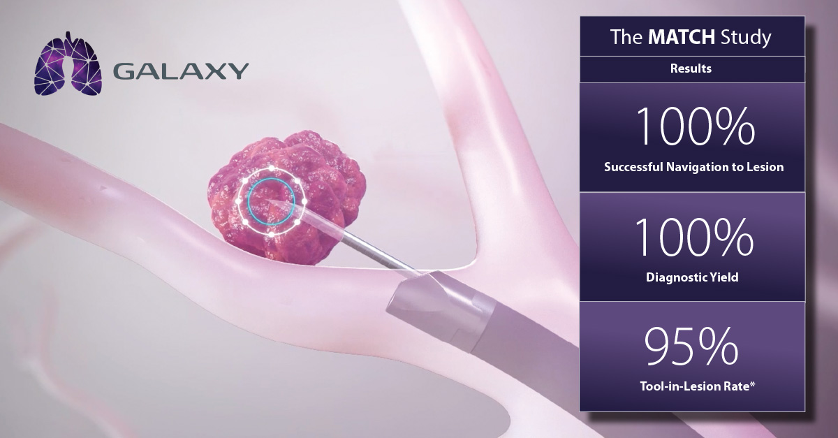 “Tool-in-lesion” Accuracy of Galaxy System A Robotic Electromagnetic ...